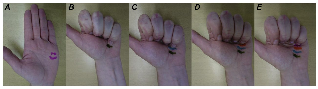 6 Top Exercises to Teach Your Patients in Hand Therapy - ReHand ...