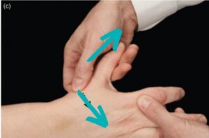 Differential Diagnosis of Radial-Side Wrist Pain - ReHand ...
