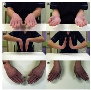 Differential Diagnosis of Radial-Side Wrist Pain [+FREE EBOOK] - ReHand ...