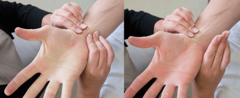 Allen Test of the Hand. What does the most up-to-date studies says ...