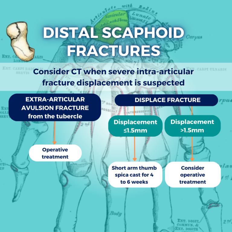 Scaphoid Fracture of the Wrist: 8 Points You Need to Know [+ Clinical ...